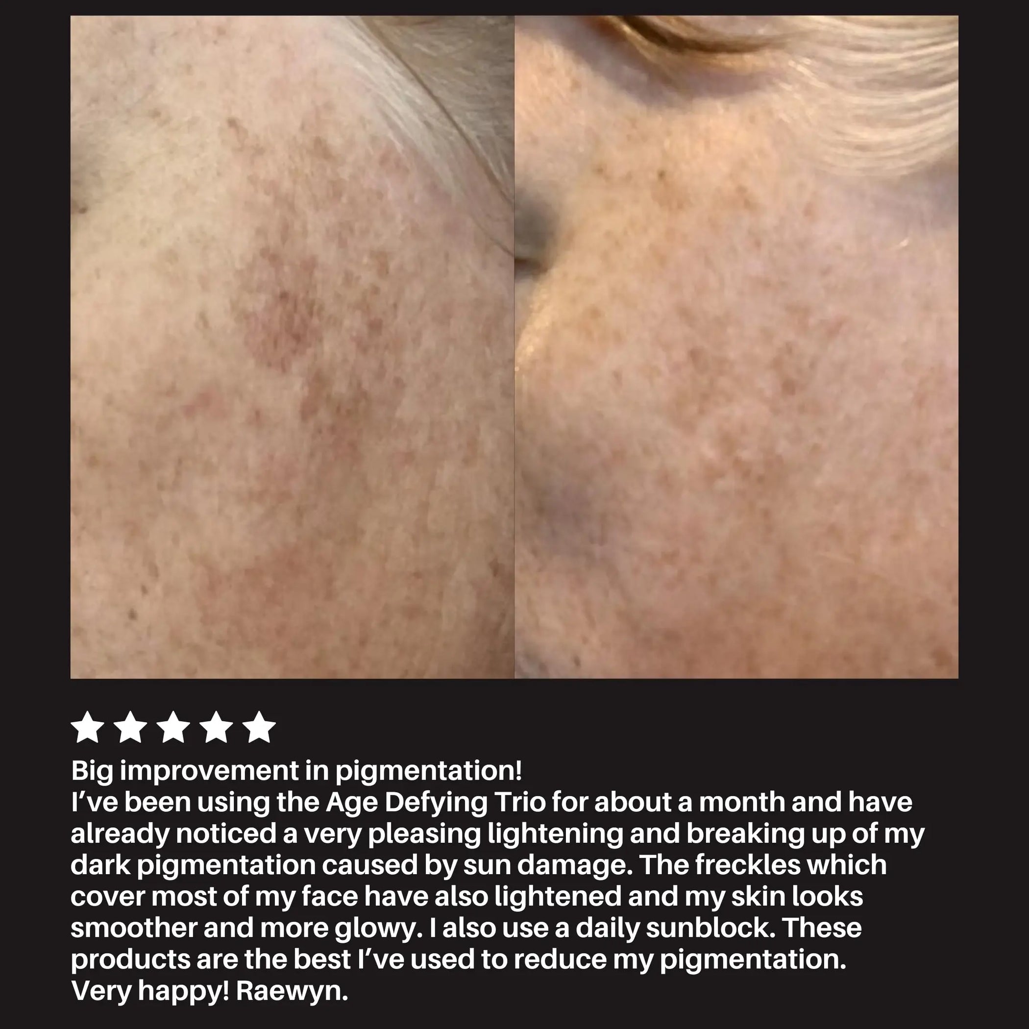 3 Step Age Defying Skincare Routine | Smoother, Radiant Skin – Pals ...