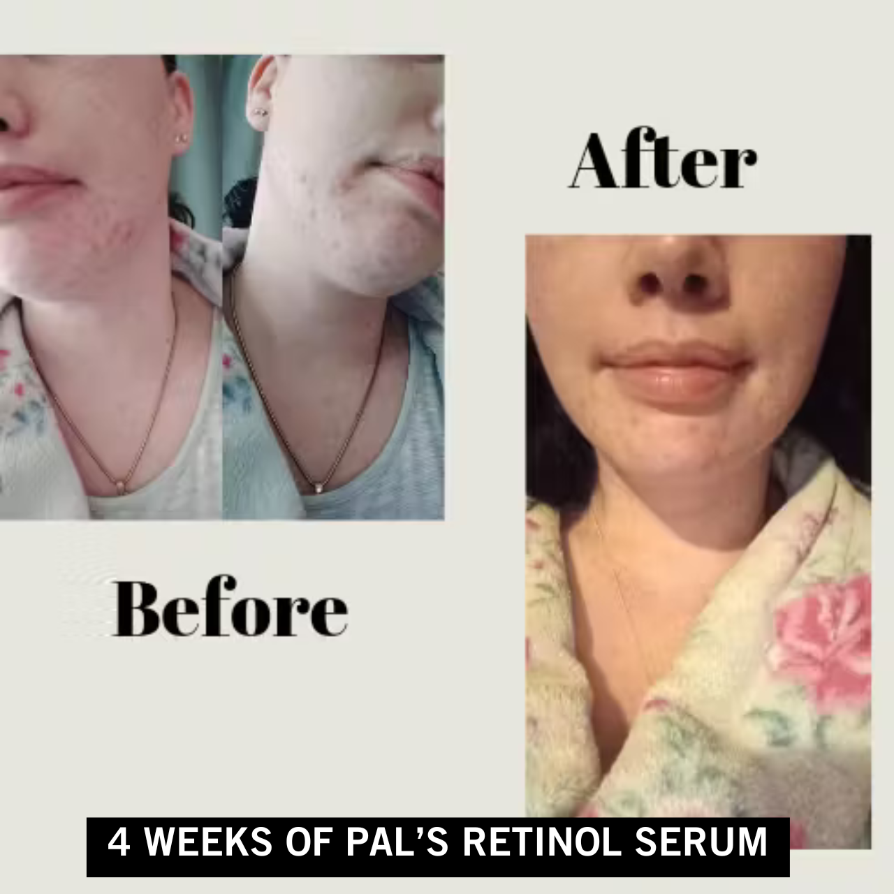 NZ’s Best Skincare for Visible Results – Pals Skin Lab